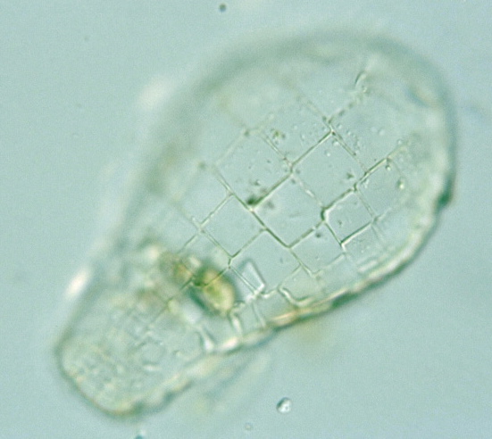 Protist Images: Quadrulella symmetrica